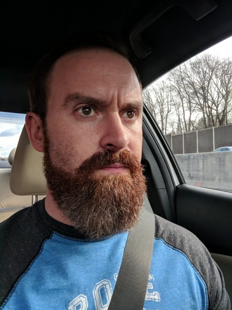 Most Common Beard Growth Problems and Their Solutions