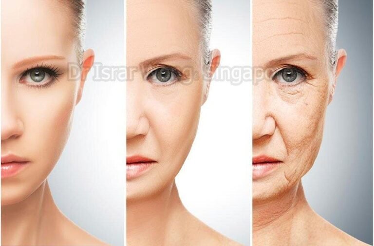 Ellanse: Dermal Fillers that Promise Long Lasting Non-surgical Facelift