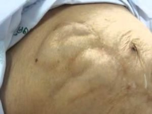 Do People Poop When They Die?