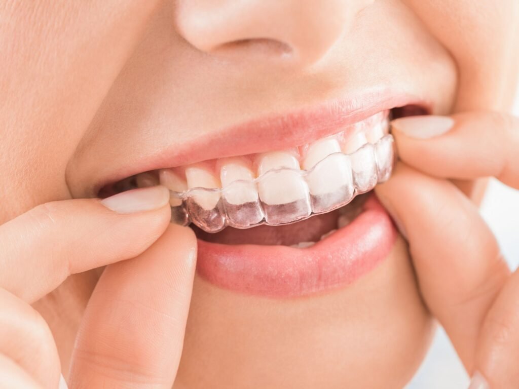 Understanding Invisalign Costs: A Deep Dive